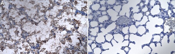 Anti-Glucuronoxylomannan/GXM Antibody, clone 3E5 | MABF3125-25UG